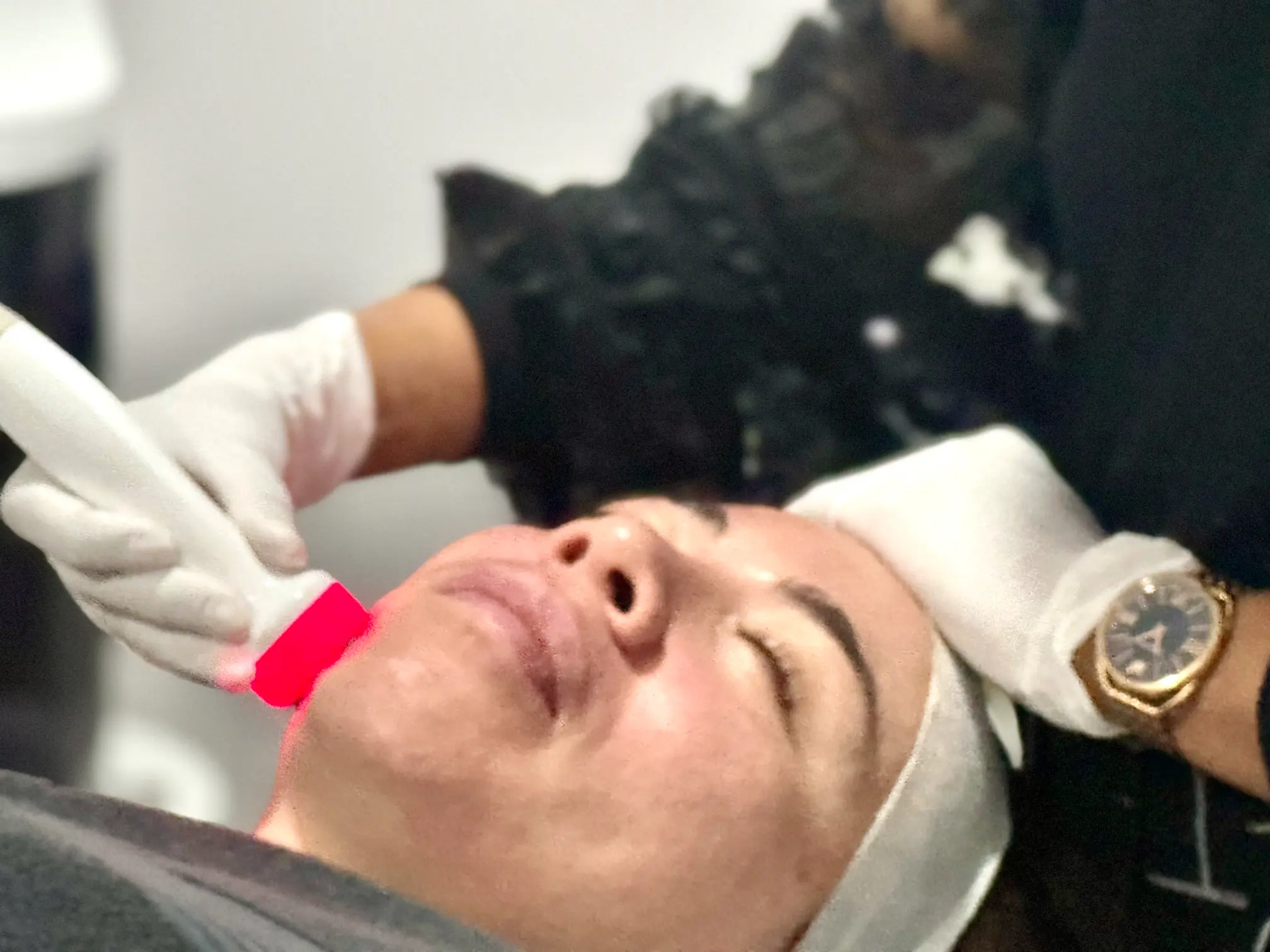 Tixel Skin Resurfacing | Gentle Treatment for Lasting Results
